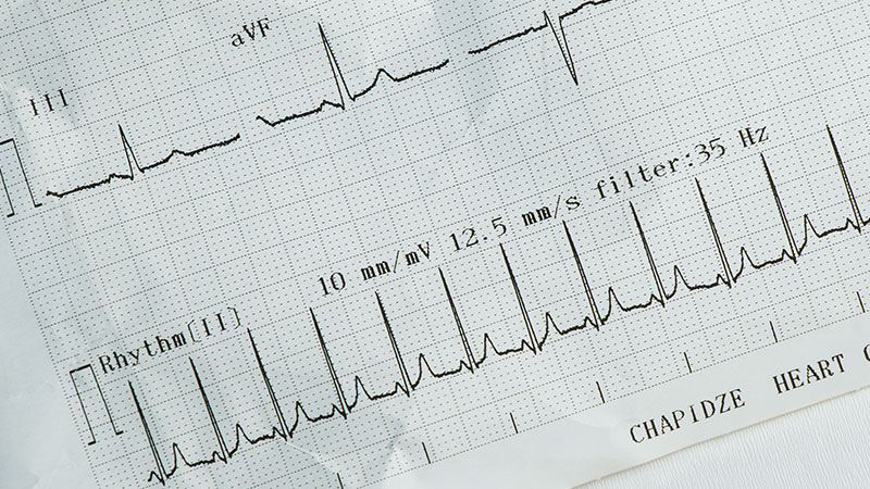 12 Signs and Symptoms of Heart Disease: What Not to Take Lightly ...