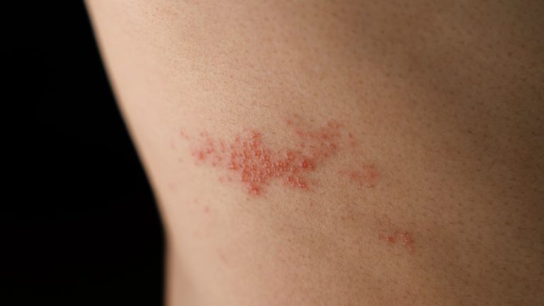 11 Causes of Chest Pain That Aren't a Heart Attack - Senior Fitness