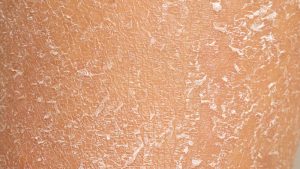 How to Hydrate Fast: Effective Tips for Quick Rehydration - Senior Fitness